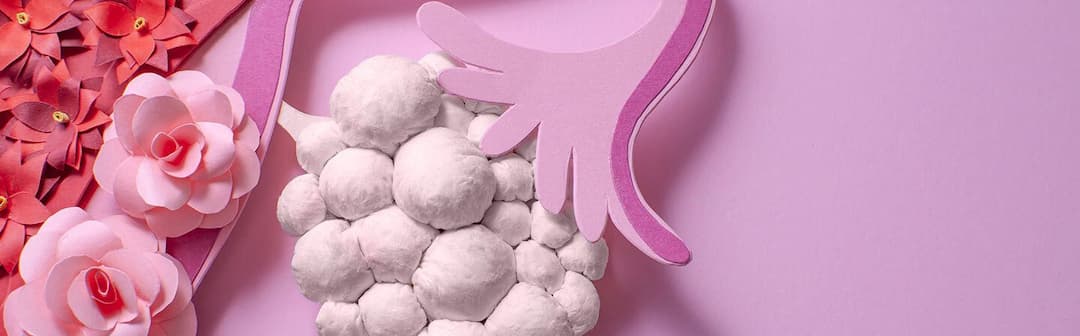 PCOD Problems, Symptoms, Causes, and Treatments